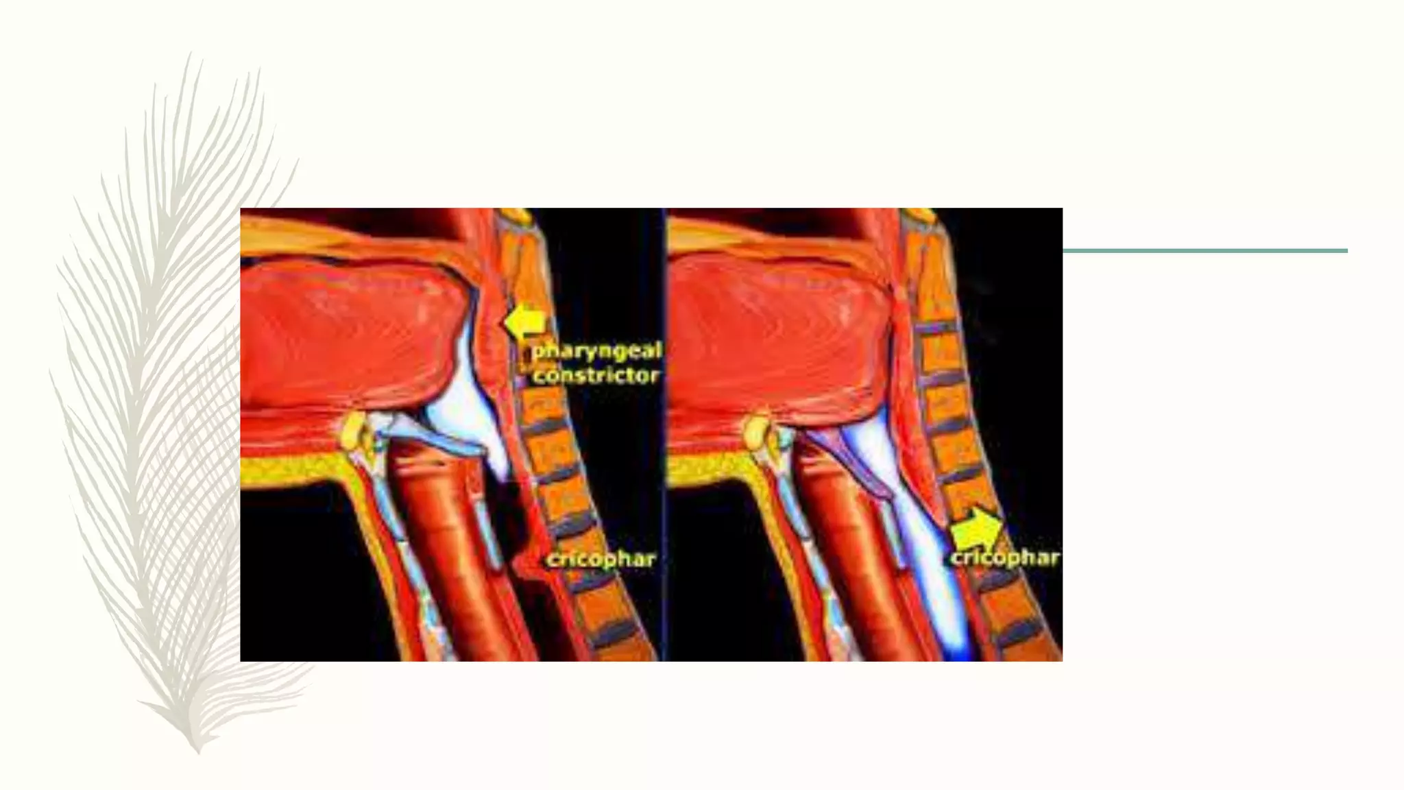 Anatomy of esophagus and physiology of swallowing | PPTX