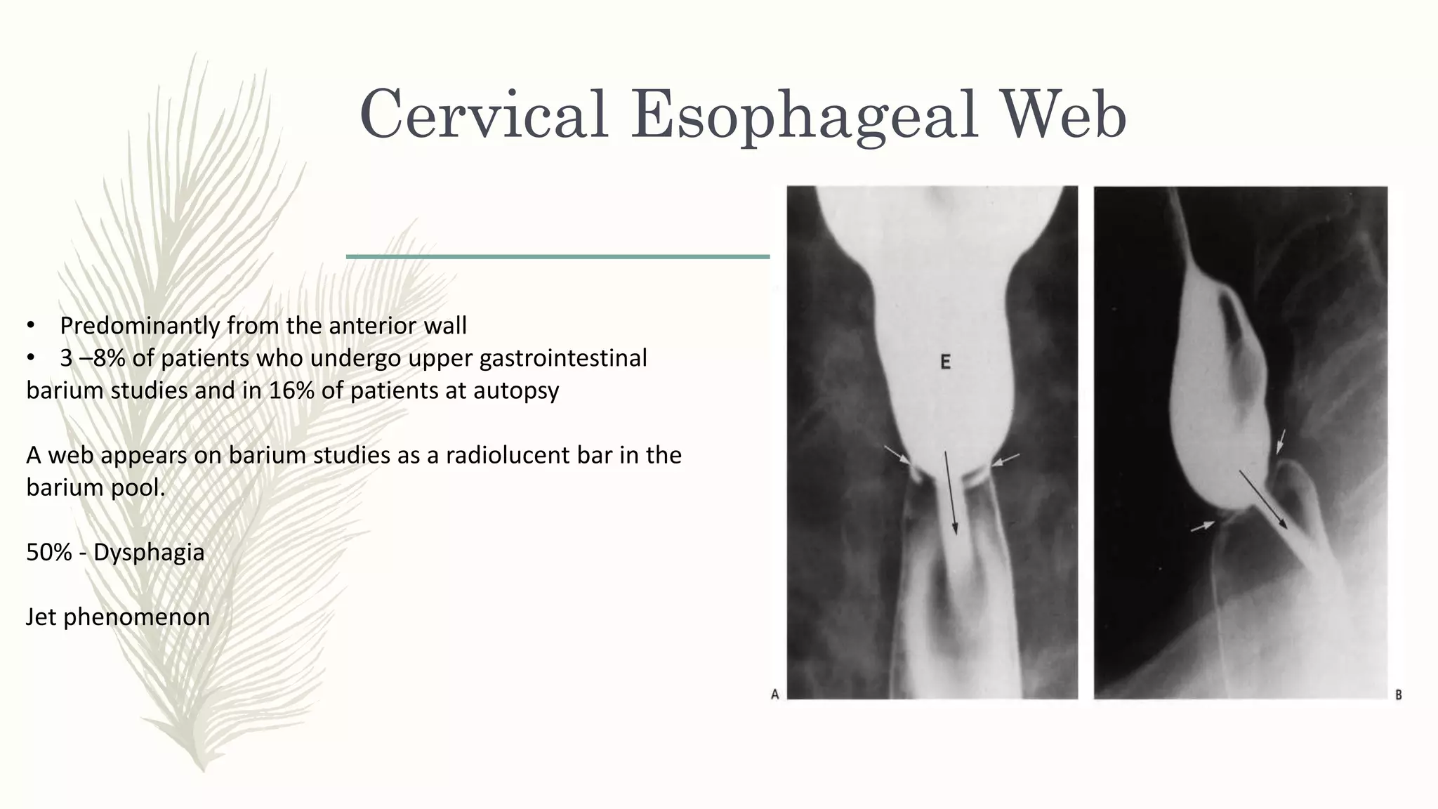 Anatomy of esophagus and physiology of swallowing | PPTX