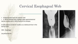 Anatomy of esophagus and physiology of swallowing | PPT