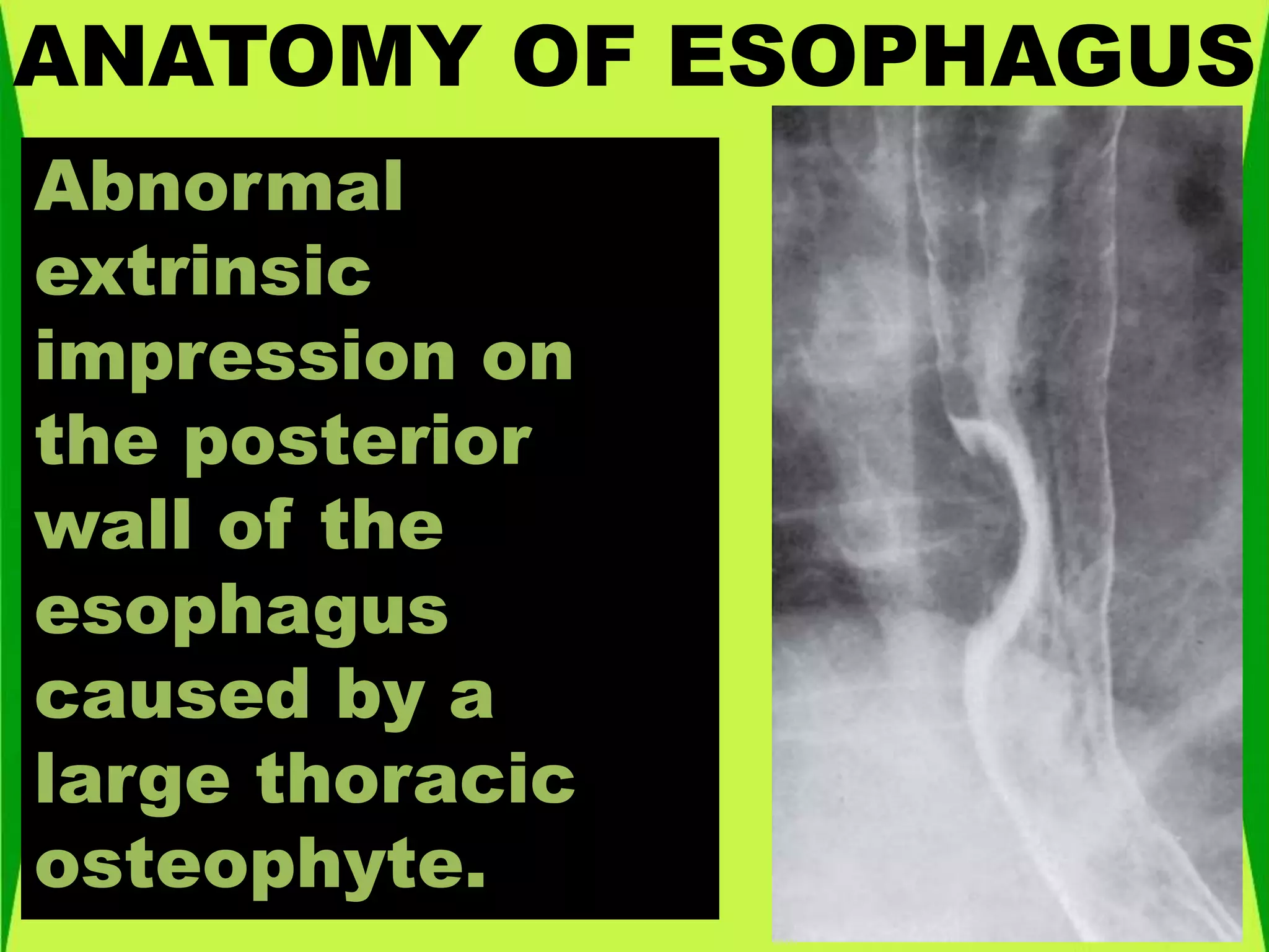 Anatomy of esophagus | PPTX