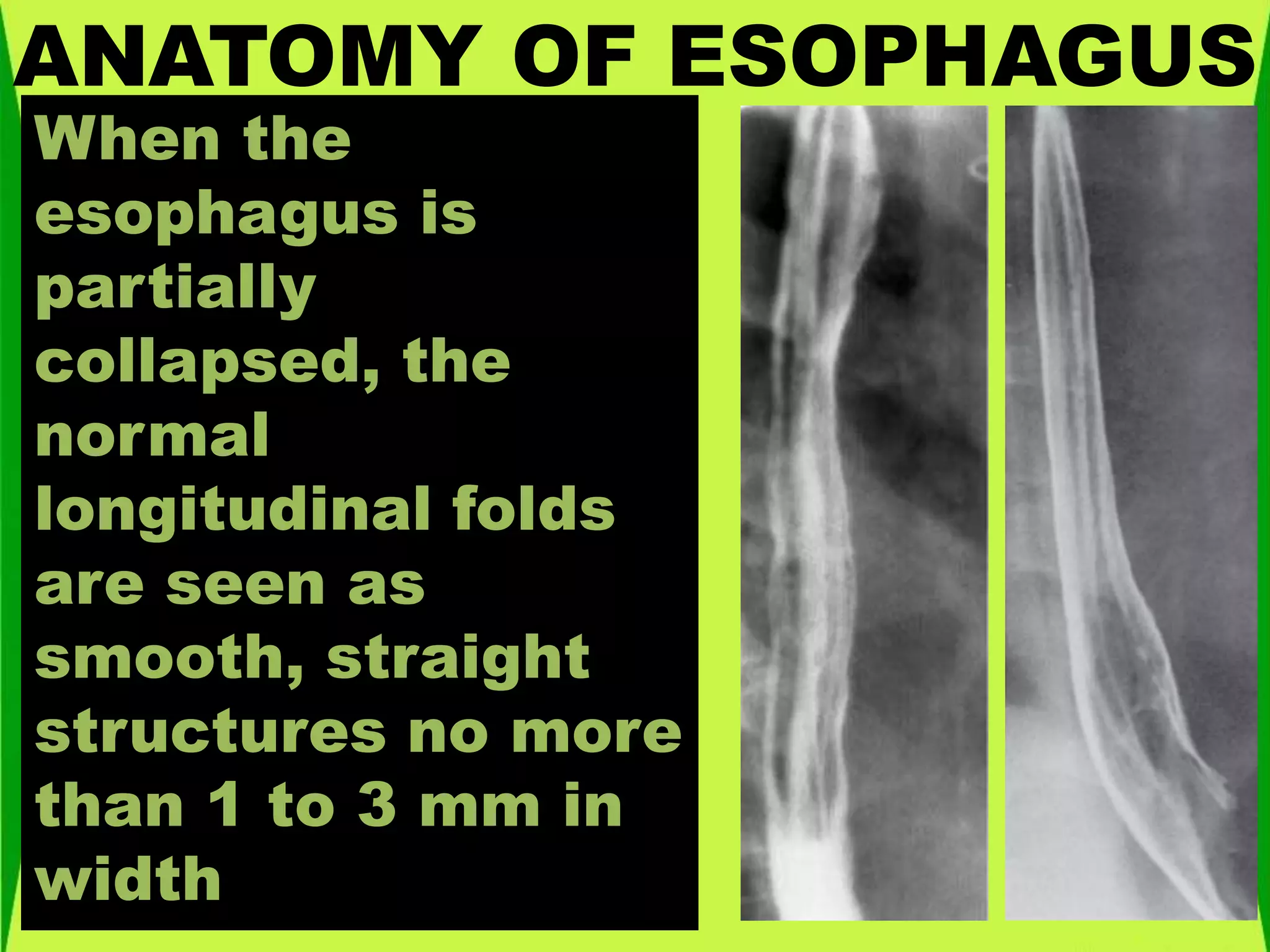 Anatomy of esophagus | PPTX