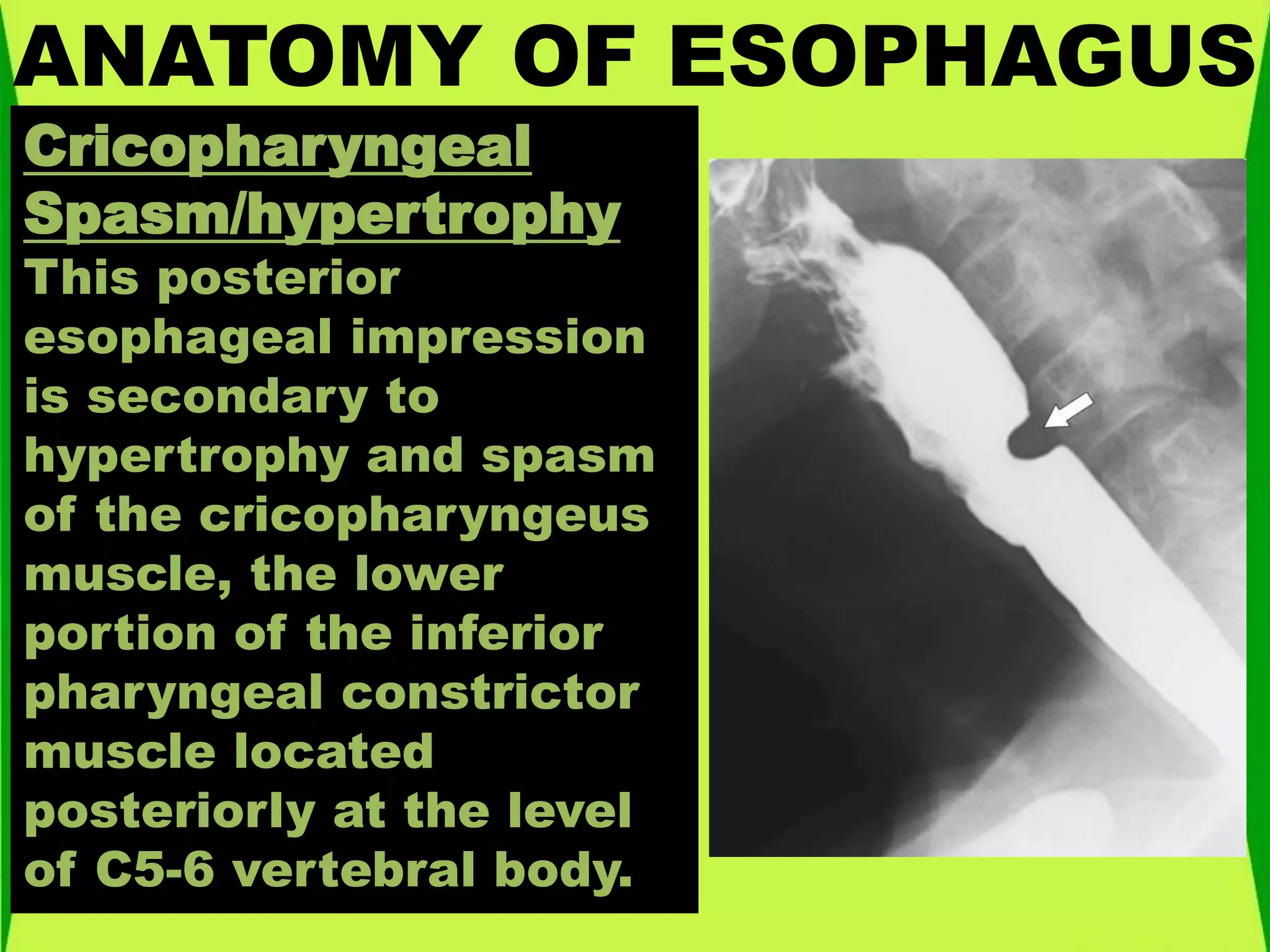 Anatomy of esophagus | PPTX