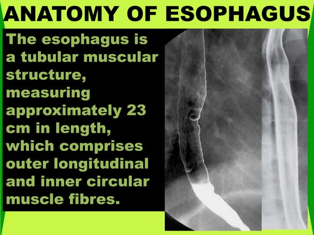 Anatomy of esophagus | PPT