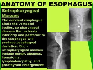 Anatomy of esophagus | PPTX