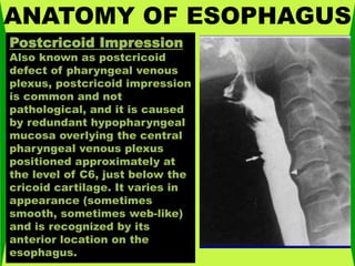 Anatomy of esophagus | PPTX
