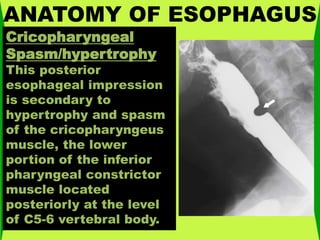 Anatomy of esophagus | PPTX