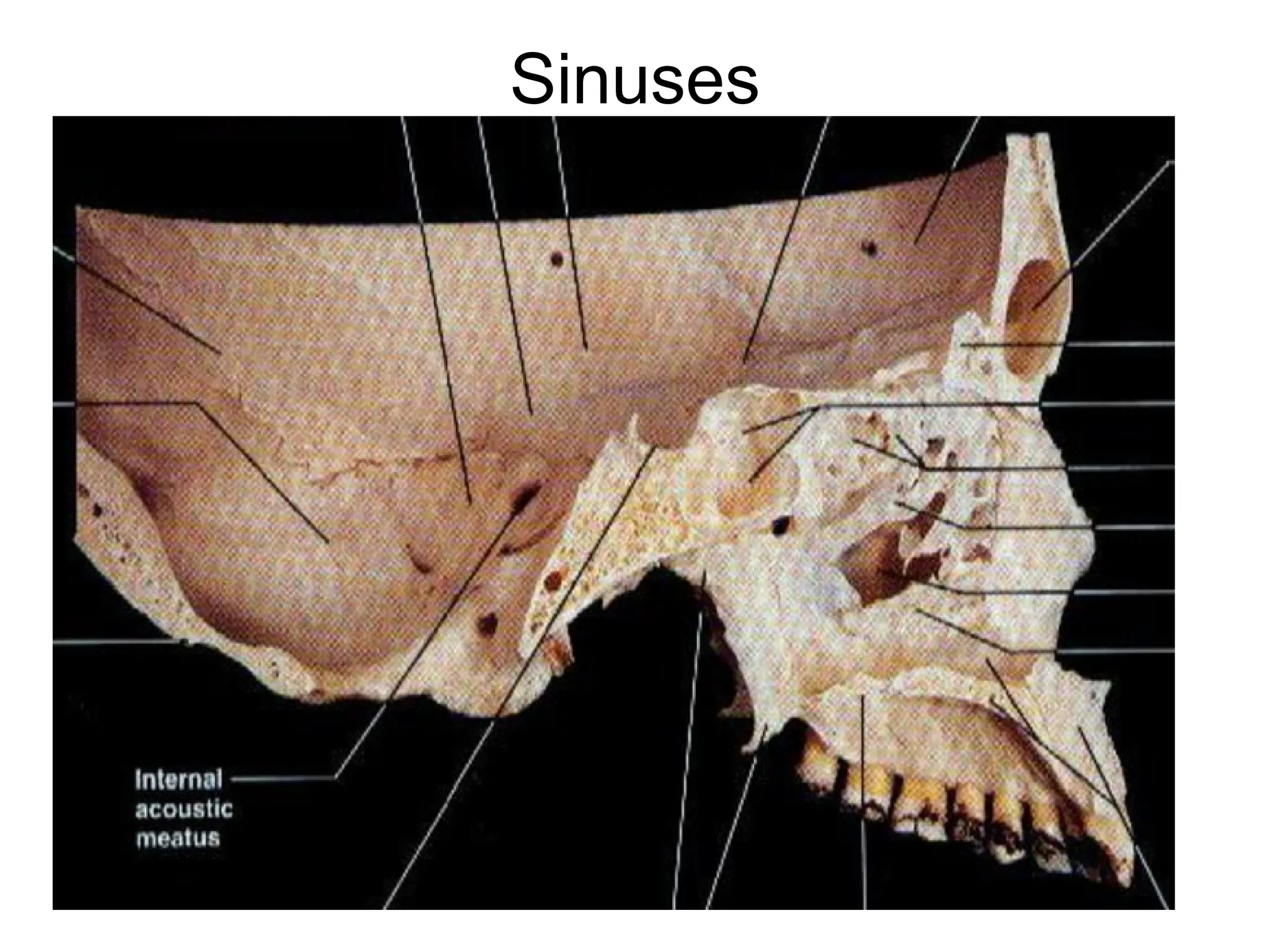 Anatomy of ethmoid bone and ethmoid sinus | PPT