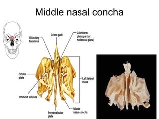 Anatomy of ethmoid bone and ethmoid sinus | PPT