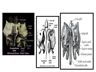 Anatomy of ethmoid bone and ethmoid sinus | PPT
