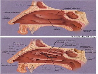 Anatomy of ethmoid bone and ethmoid sinus | PPT