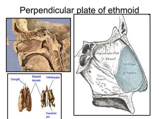 Anatomy of ethmoid bone and ethmoid sinus | PPT