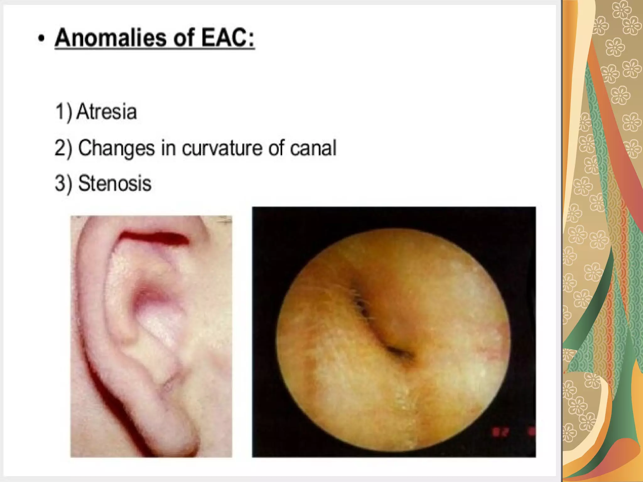 Anatomy of external ear | PPT