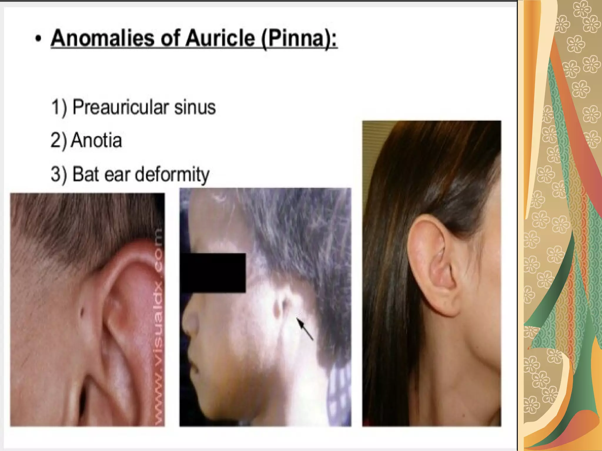 Anatomy of external ear | PPT