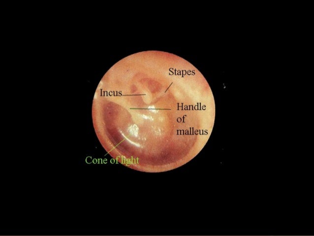 Anatomy of external ear