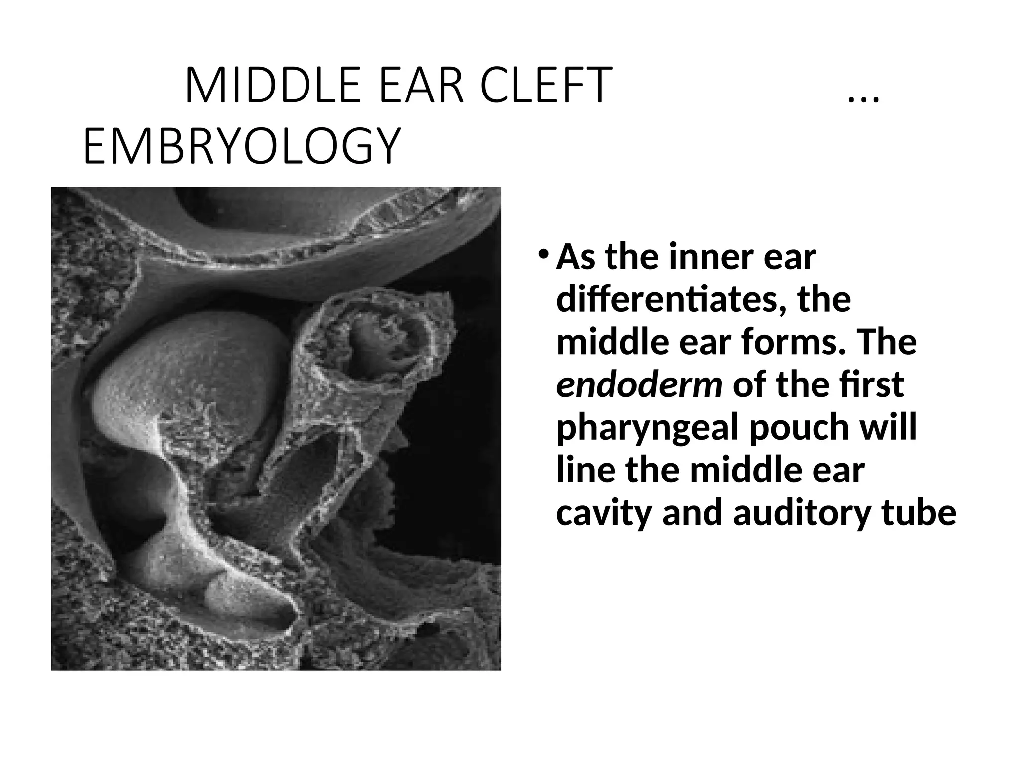 Anatomy Of External And Middle Ear .ppt