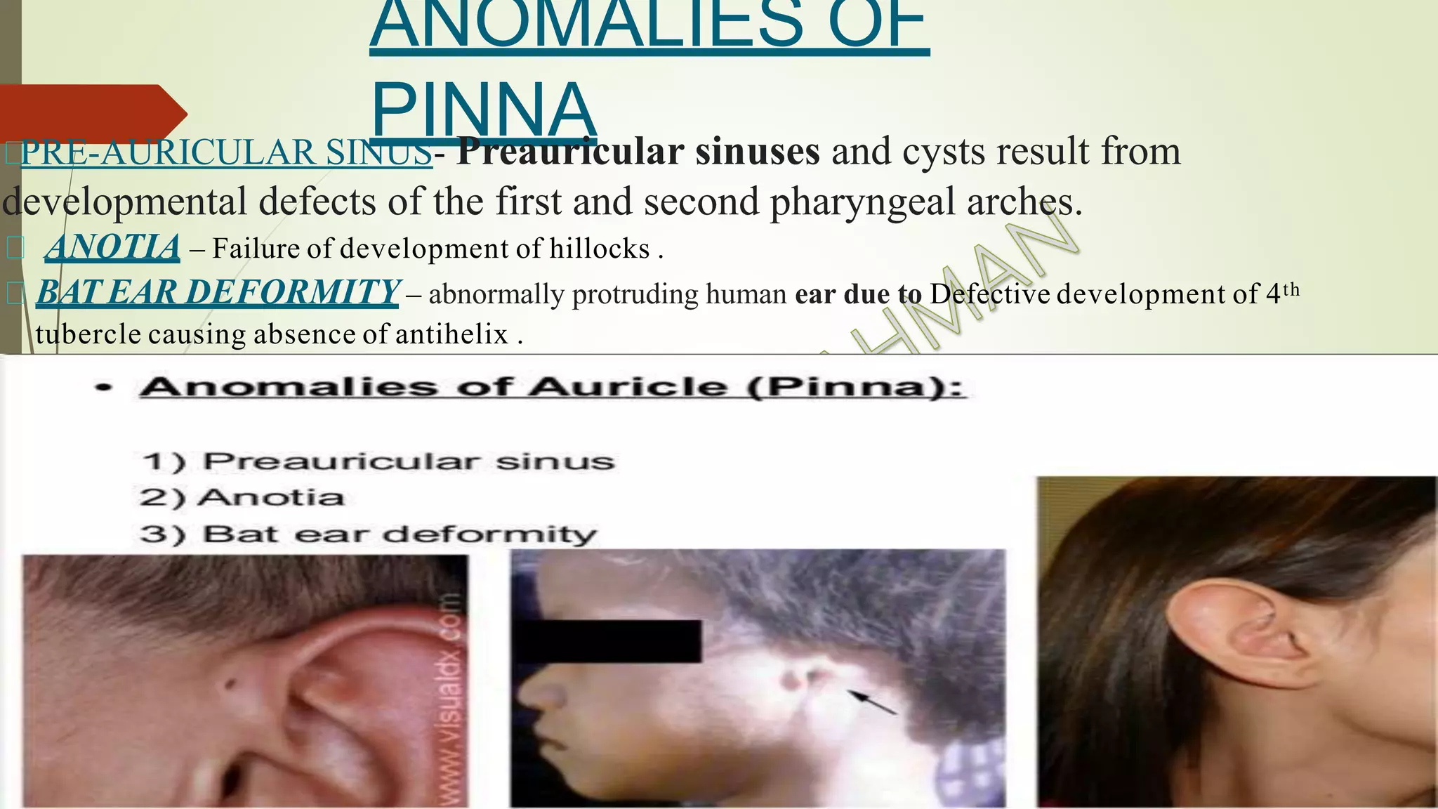 Anatomy of external and middle ear by dr. faisal rahman | PPTX