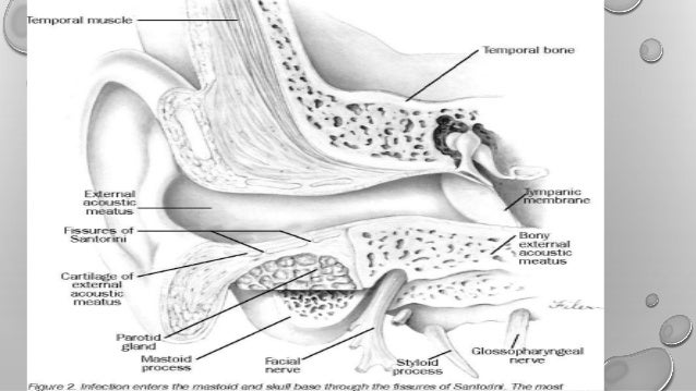 Anatomy of external ear -- ent