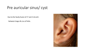 anatomy of external ear ^0 middle ear.pptx
