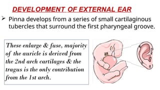 ANATOMY OF EXTERNAL EAR AND MIDDLE EAR.pptx