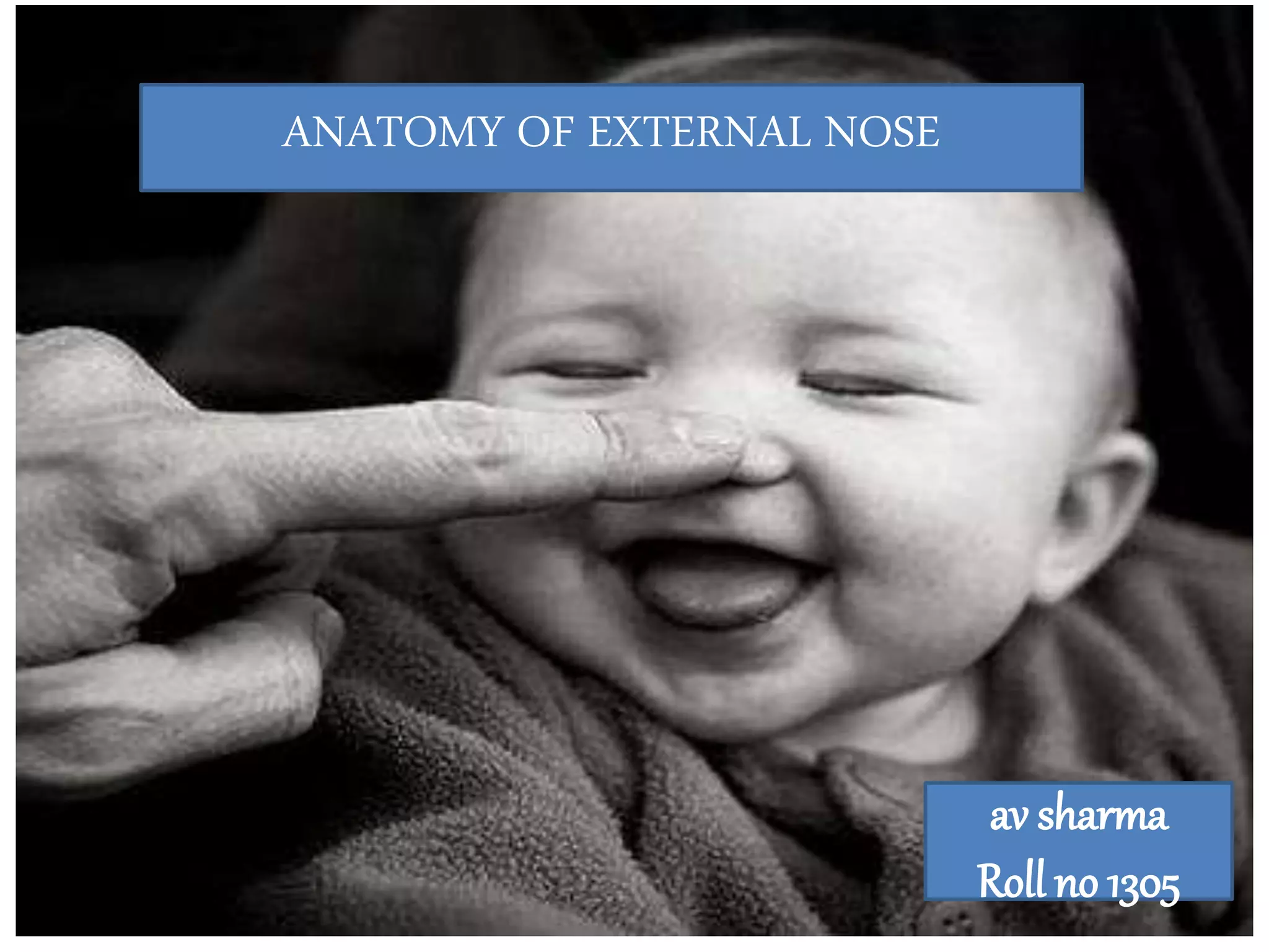 Anatomy of external nose by av sharma | PPTX