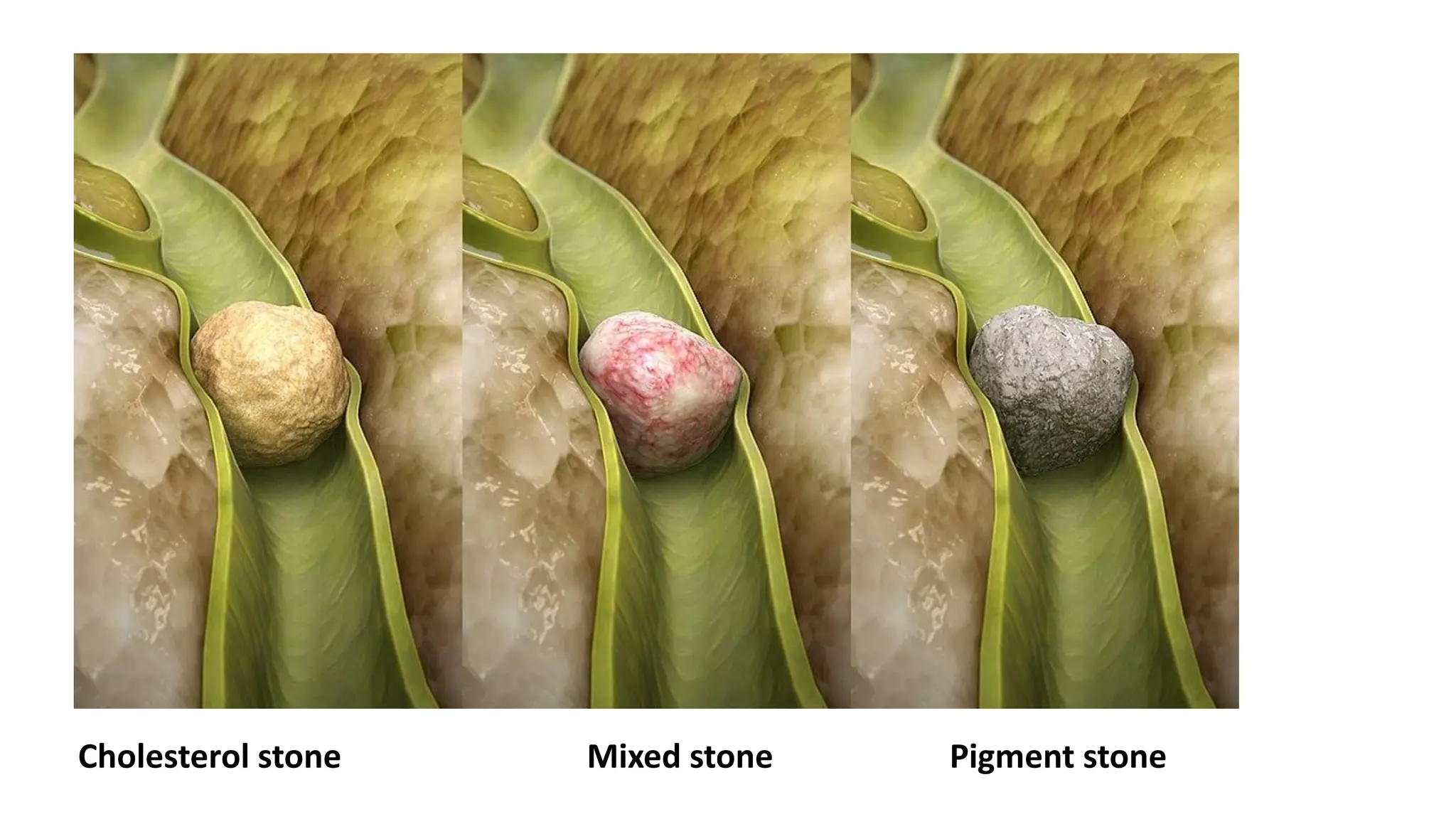 Gross anatomy and histology of extrahepatic biliary apparatus | PDF