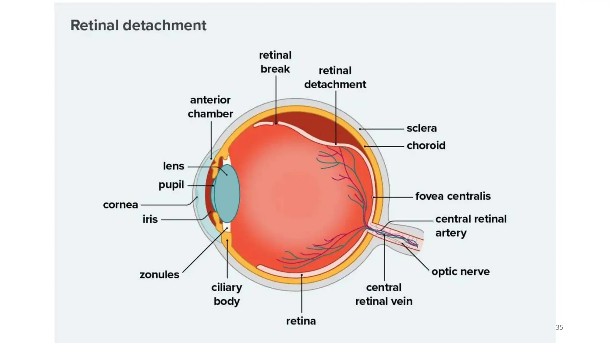 Applied Anatomy of Orbit and Eyeball.pptx