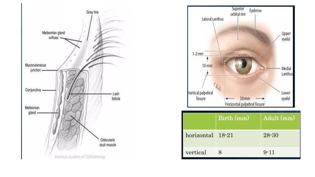 Anatomy of eyelid-ophthalmology MBBS. Description of anatomy of eyelid ...