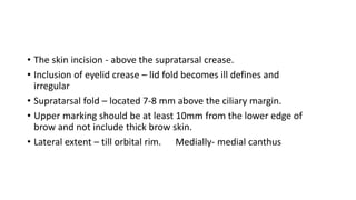 Anatomy Of Eyelid And Blepharoplasty.pptx