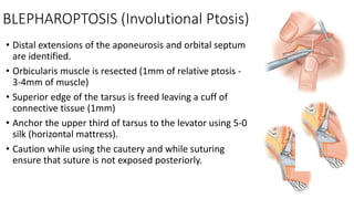 Anatomy Of Eyelid And Blepharoplasty.pptx