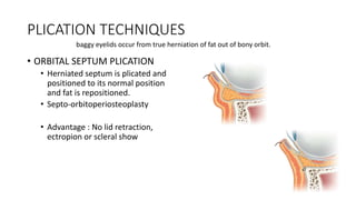 Anatomy Of Eyelid And Blepharoplasty.pptx