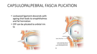 Anatomy Of Eyelid And Blepharoplasty.pptx