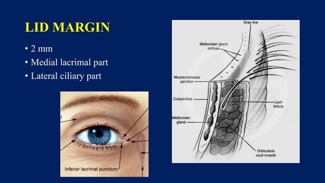 Anatomy Of Eyelid And Eyelid Reconstruction Ppt