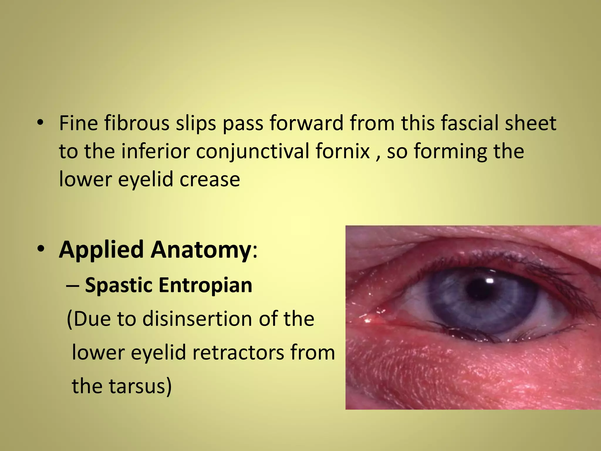 Anatomy of Eyelids & Its Clinical Correlations | PPTX