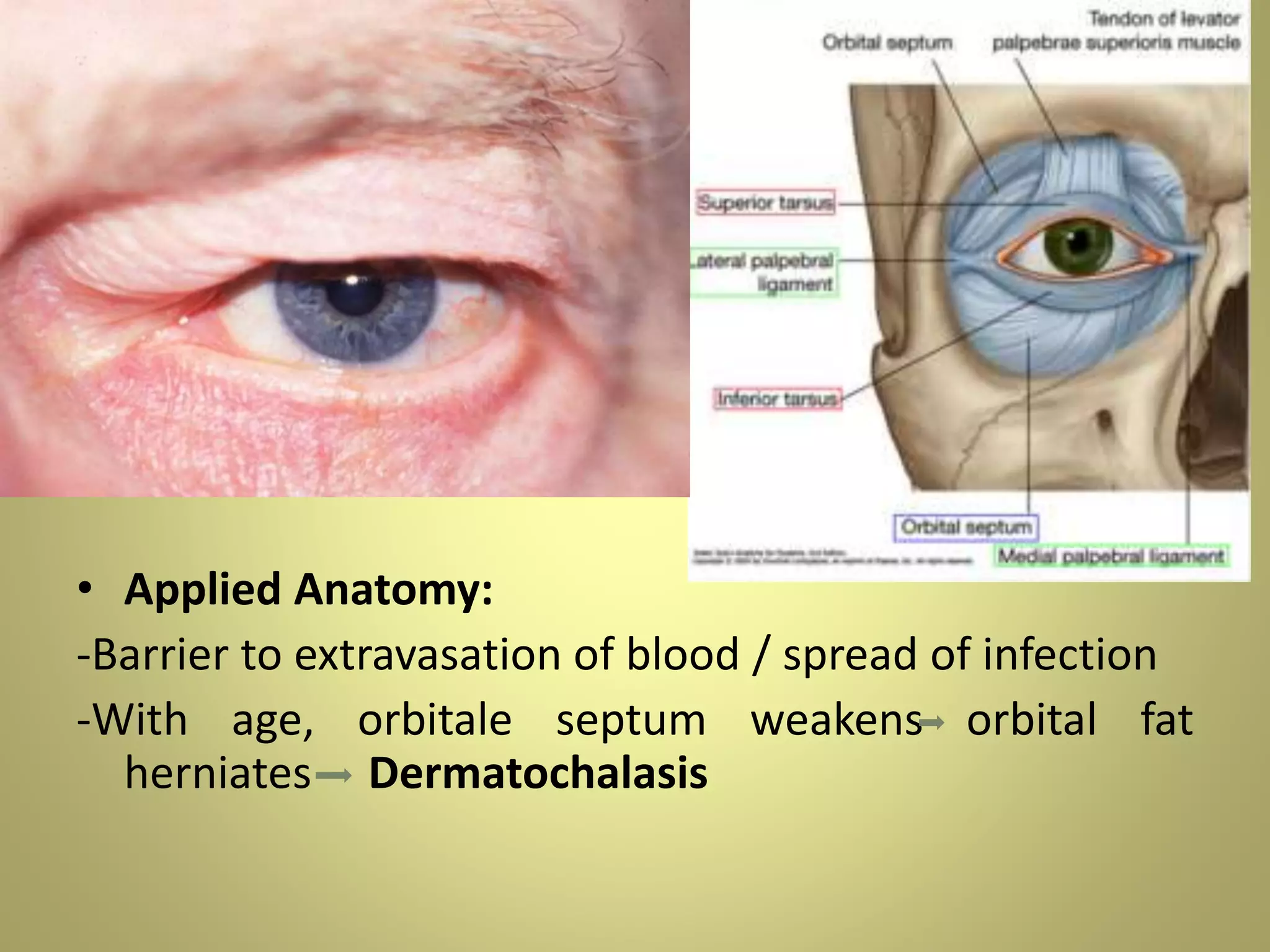Anatomy of Eyelids & Its Clinical Correlations | PPTX