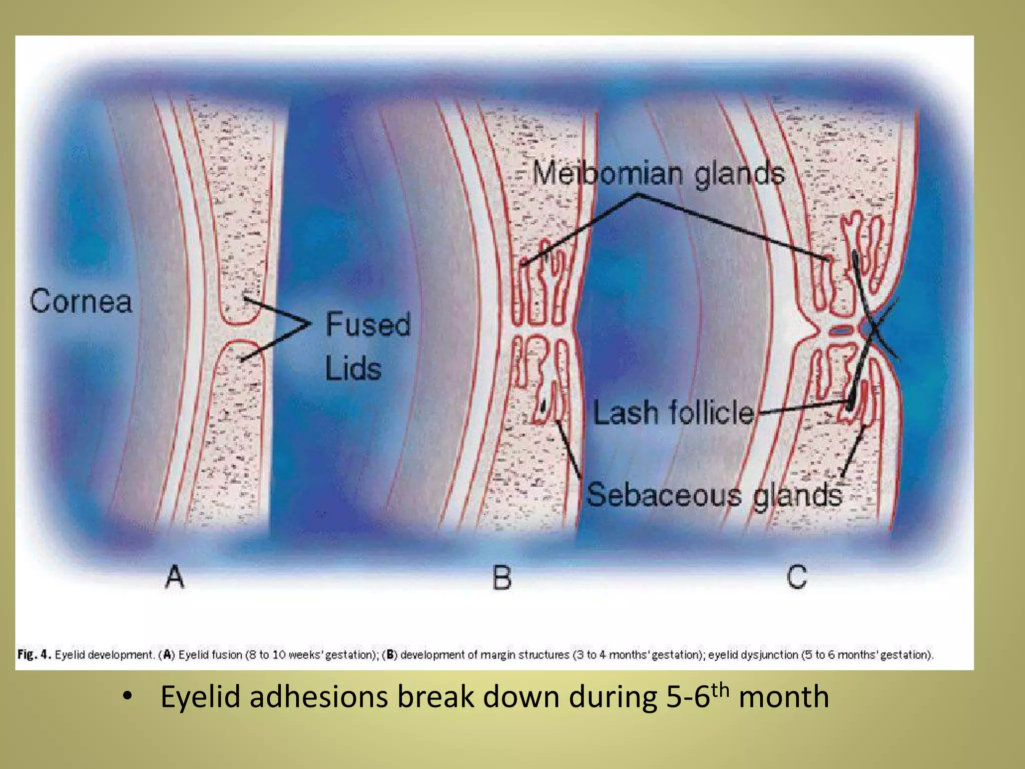 Anatomy of Eyelids & Its Clinical Correlations | PPTX