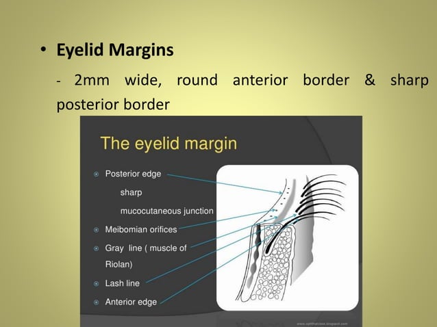 Anatomy of Eyelids & Its Clinical Correlations | PPTX