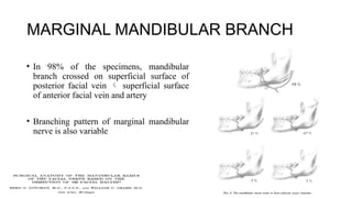 ANATOMY OF FACIAL NERVE PGIMERCHD PPT.pptx