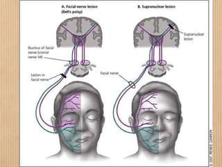 anatomy of facial nerve by tejpl singh.pptx