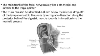 ANATOMY OF FACIAL NERVE edidteeed-1.pptx
