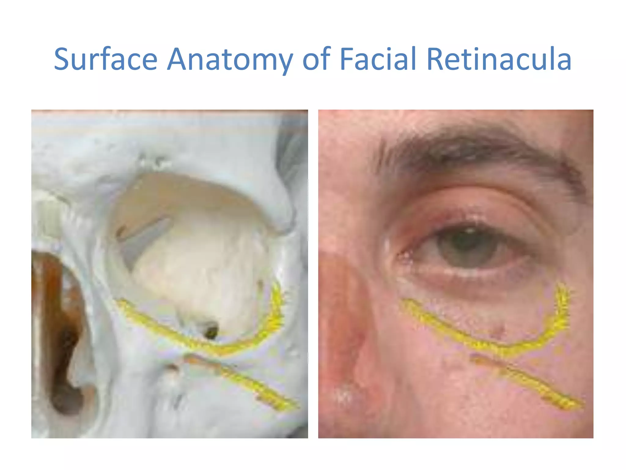 Anatomy of Facial Retinacula.ppt