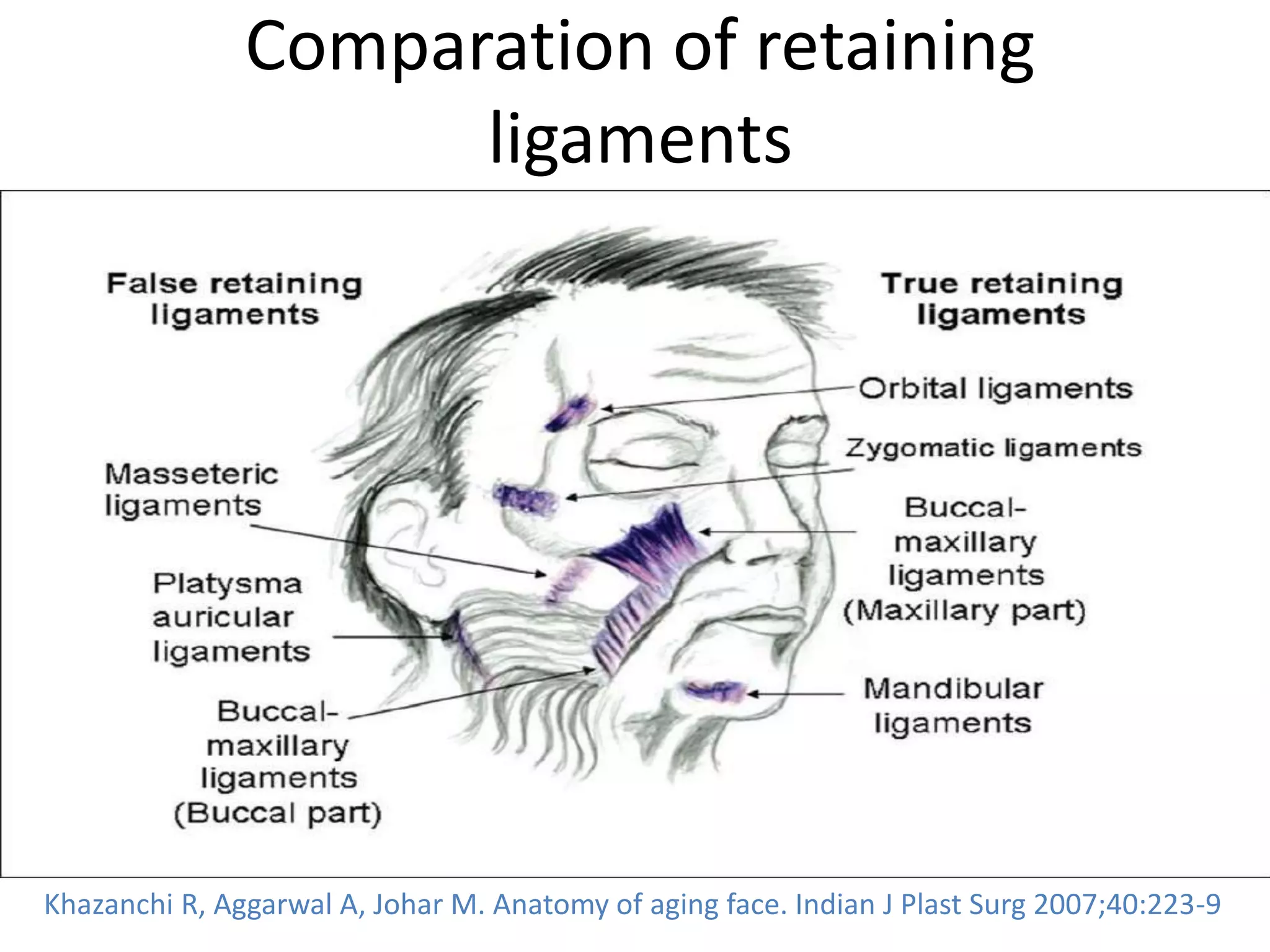 Anatomy of Facial Retinacula.ppt