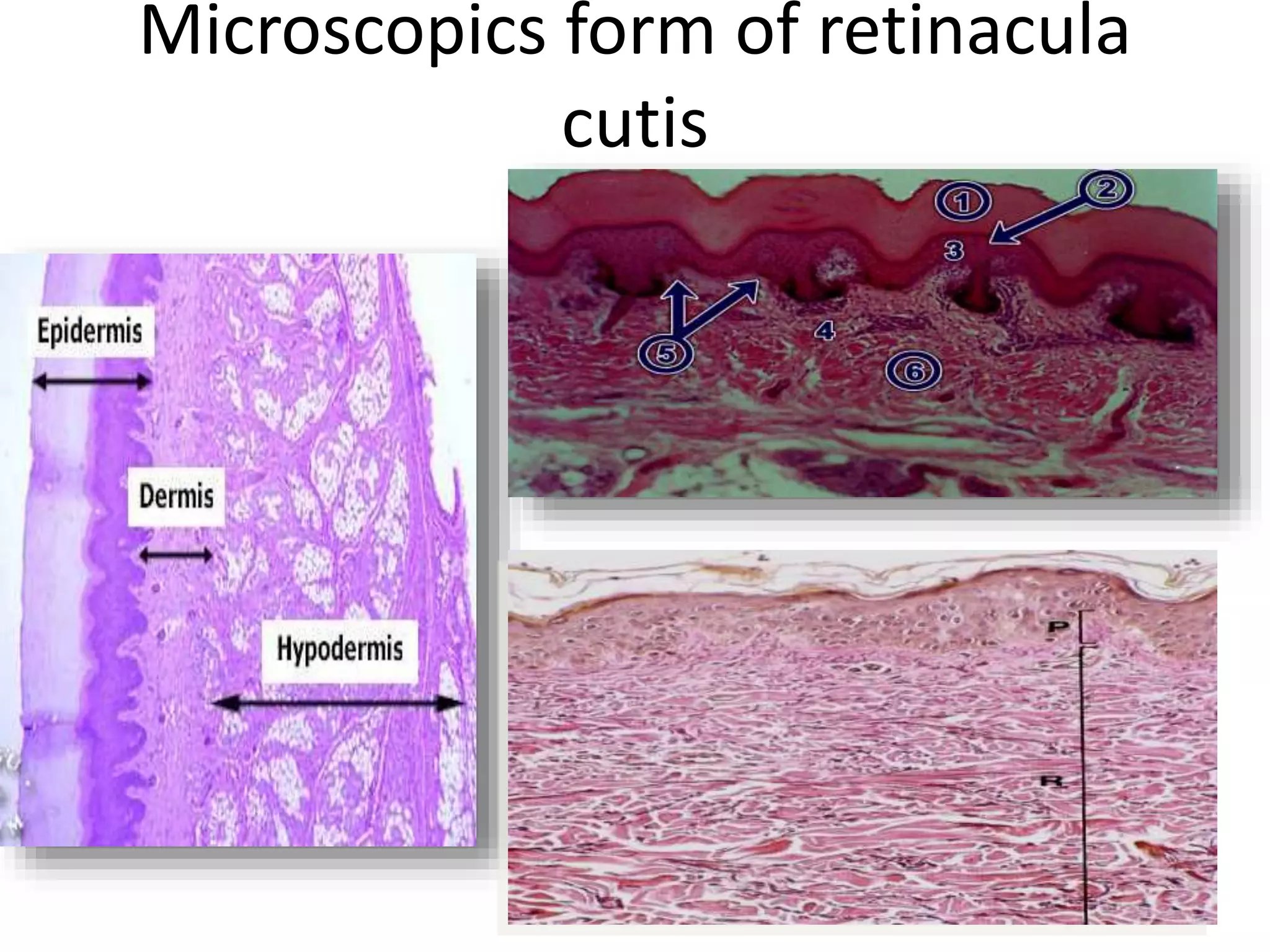 Anatomy of Facial Retinacula.ppt