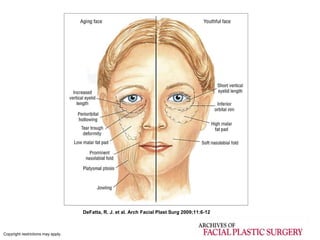 Anatomy of Facial Retinacula.ppt
