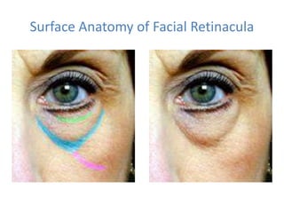 Anatomy of Facial Retinacula.ppt