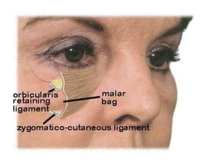 Anatomy of Facial Retinacula.ppt