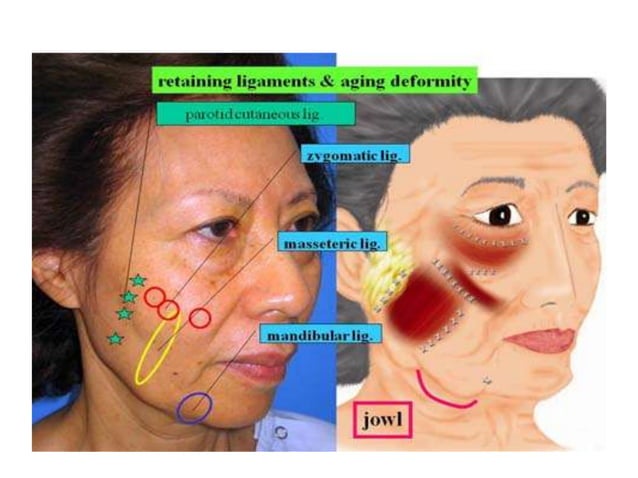 Anatomy of Facial Retinacula.ppt