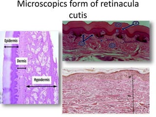 Anatomy of Facial Retinacula.ppt