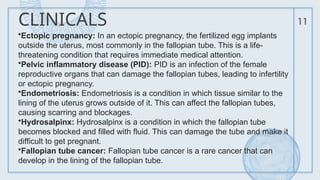 Anatomy of Fallopian Tubes Explained.pptx