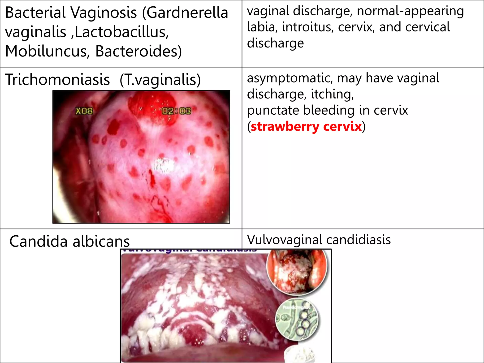 Anatomy of female genital tract | PPTX