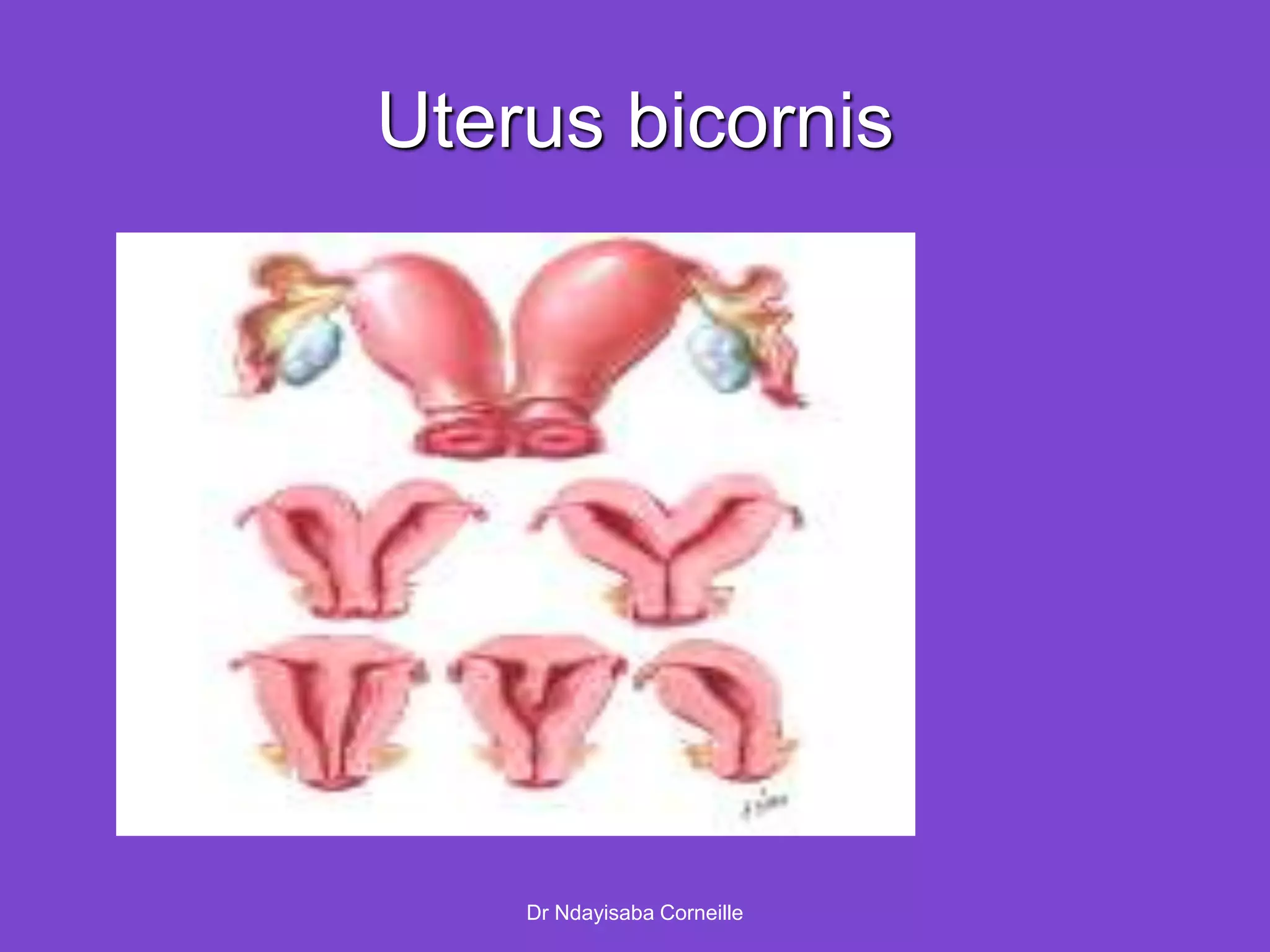Anatomy of Female internal genitalia.pptx